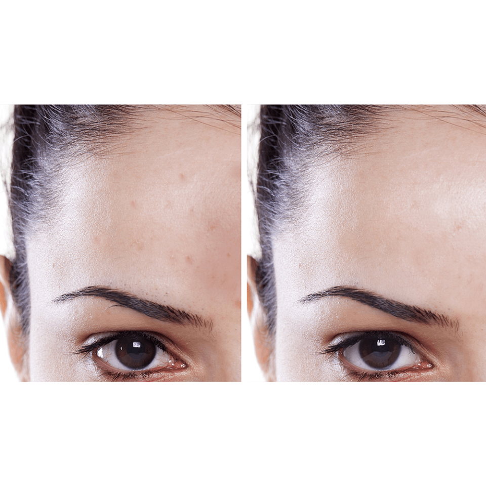 AquaGlo Hydradermabrasion System - Comfortel Singapore (SG)