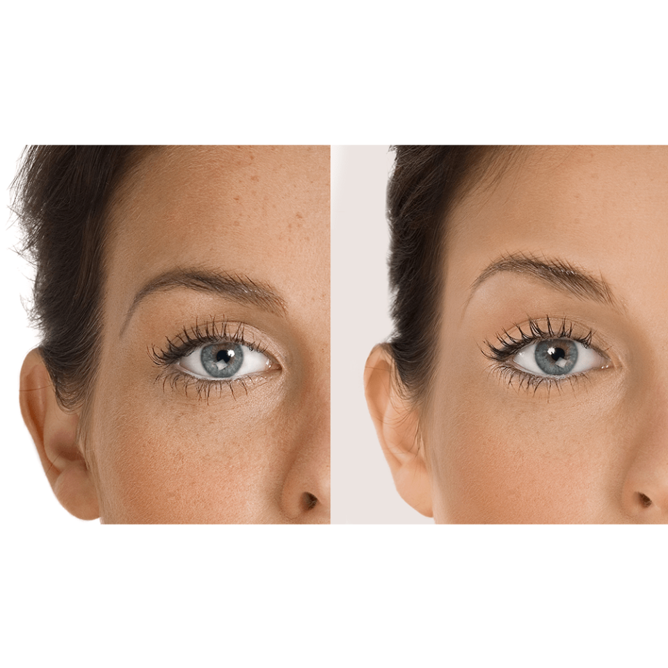 AquaGlo Hydradermabrasion System - Comfortel Singapore (SG)